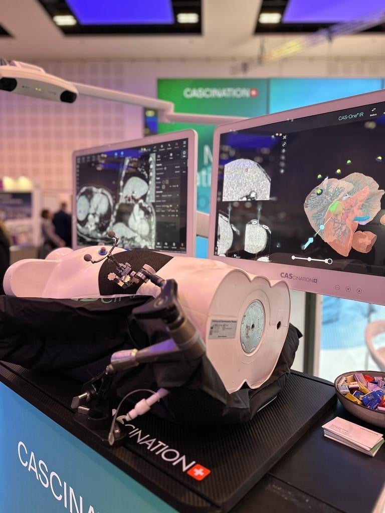 The CAS-One IR Challenge Strikes again in Wales