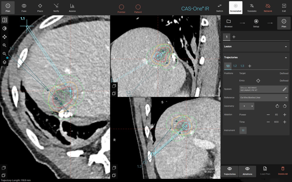 CAS-One IR 4.2 Software Features Preview