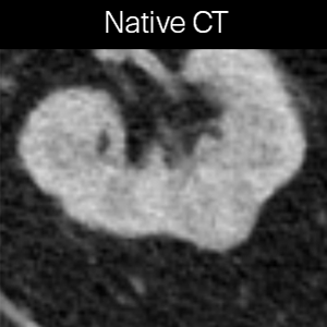 CAS - One IR 4.3 - Driven by AI