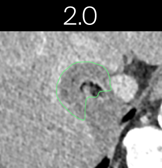 CAS - One IR 4.2 - Driven by AI